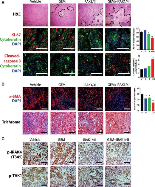 Constitutive IRAK4 Activation Underlies Poor Prognosis and ...