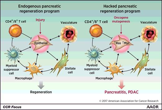Re-engineering the Pancreas Tumor Microenvironment: A Regenerative ...