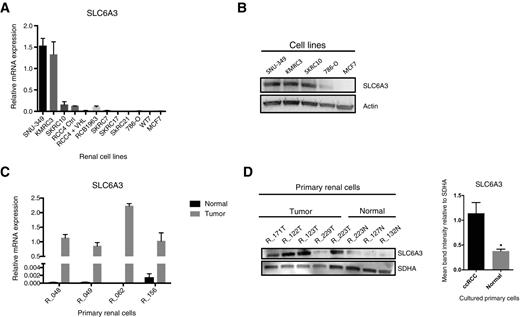 Overexpression of Functional SLC6A3 in Clear Cell Renal Cell Carcinoma ...