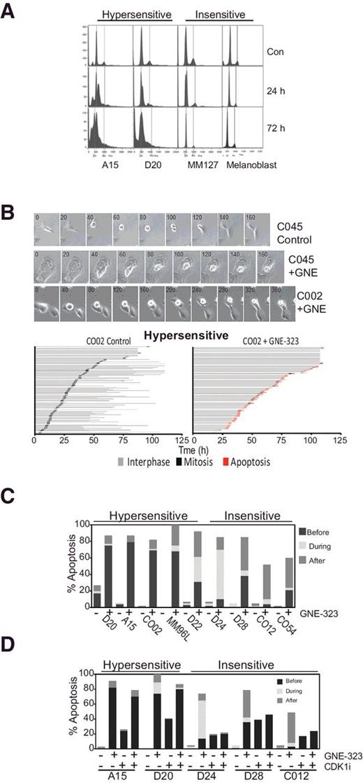 Endogenous Replication Stress Marks Melanomas Sensitive to CHEK1 ...