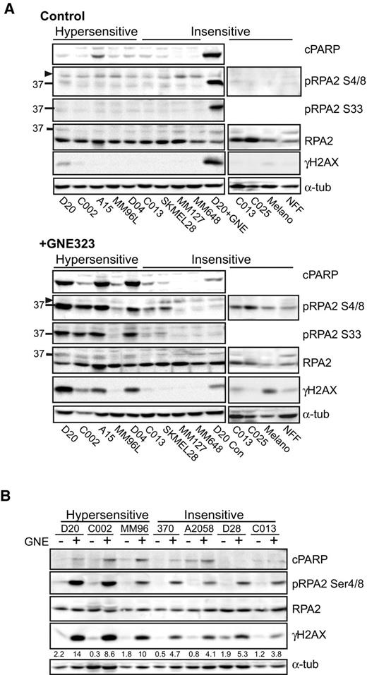 Endogenous Replication Stress Marks Melanomas Sensitive to CHEK1 ...