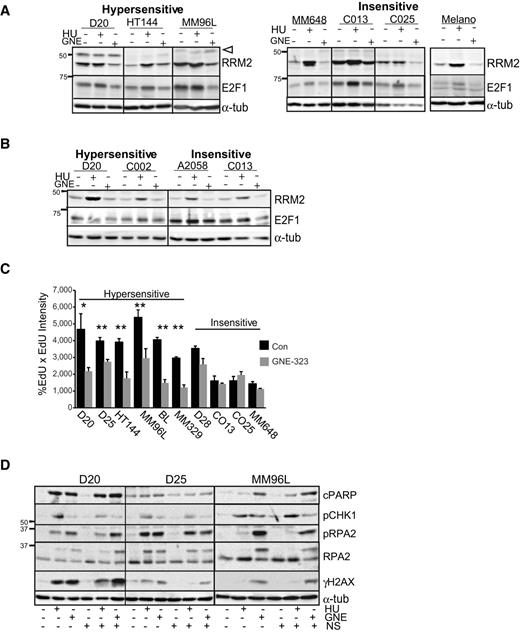 Endogenous Replication Stress Marks Melanomas Sensitive to CHEK1 ...