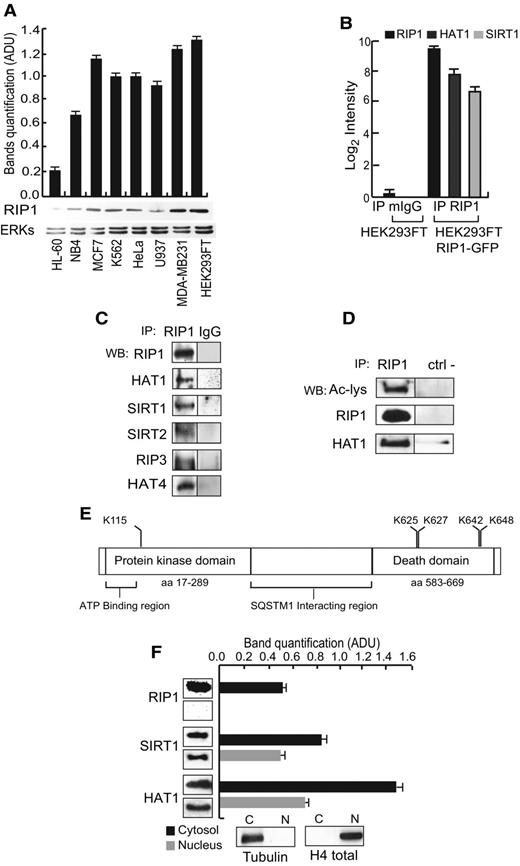 RIP1–HAT1–SIRT Complex Identification and Targeting in Treatment and ...