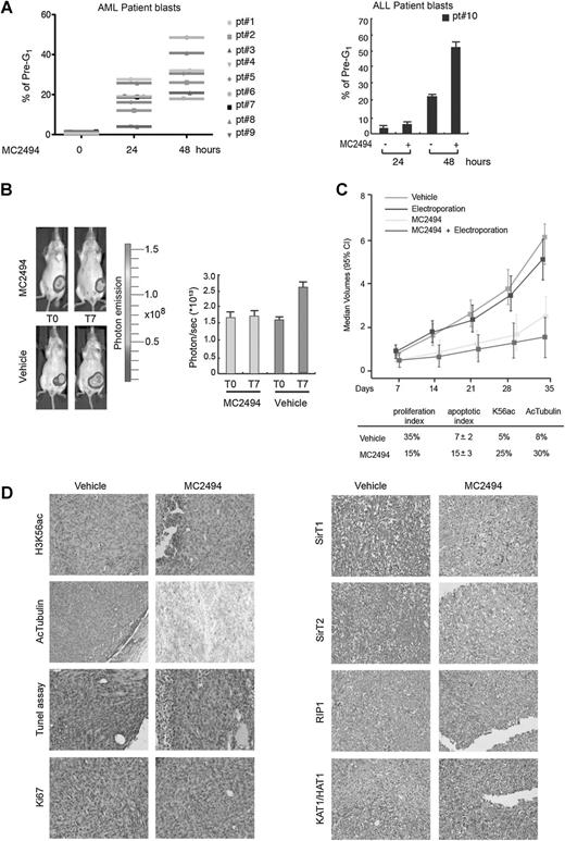 RIP1–HAT1–SIRT Complex Identification and Targeting in Treatment and ...