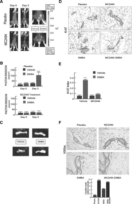 RIP1–HAT1–SIRT Complex Identification and Targeting in Treatment and ...