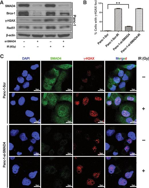 SMAD4 Gene Mutation Renders Pancreatic Cancer Resistance to ...