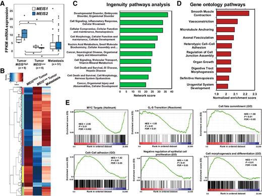 MEIS1 and MEIS2 Expression and Prostate Cancer Progression: A Role For ...