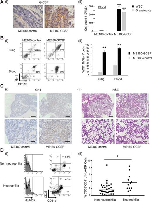 The Highly Metastatic Nature of Uterine Cervical/Endometrial Cancer ...