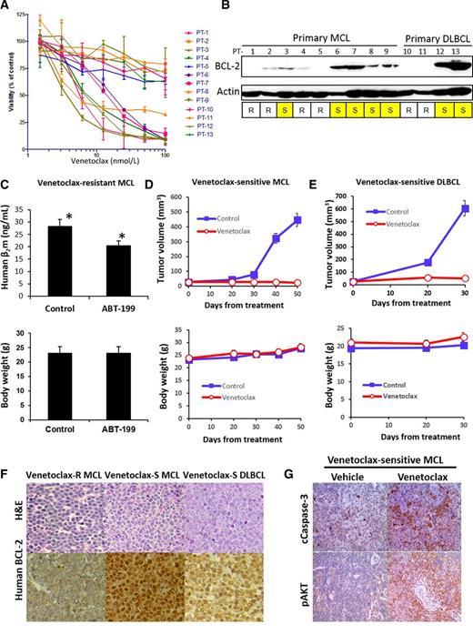 Strategic Therapeutic Targeting to Overcome Venetoclax Resistance in Aggressive B-cell Lymphomas ...