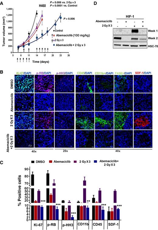 Abemaciclib, a Selective CDK4/6 Inhibitor, Enhances the ...