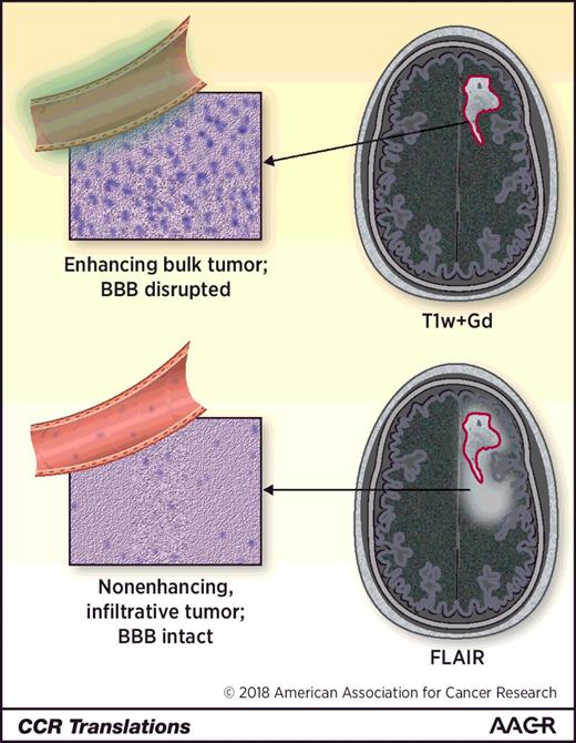 Targeted Therapies for Brain Tumors: Will They Ever Deliver? | Clinical ...