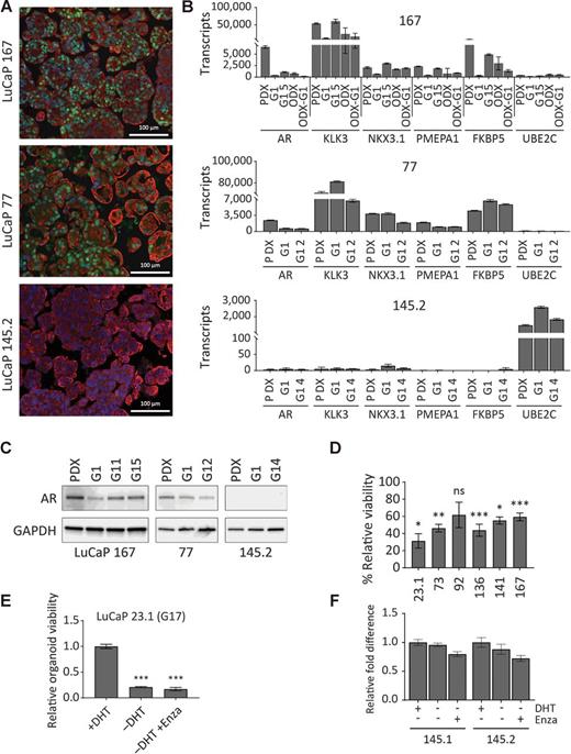 A PDX/Organoid Biobank of Advanced Prostate Cancers Captures Genomic ...