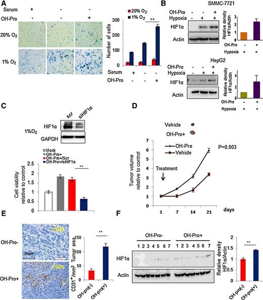 Global Metabolic Profiling Identifies a Pivotal Role of Proline and ...
