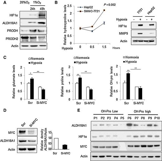 Global Metabolic Profiling Identifies a Pivotal Role of Proline and ...