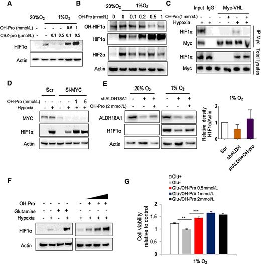 Global Metabolic Profiling Identifies a Pivotal Role of Proline and ...