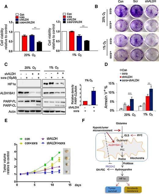 Global Metabolic Profiling Identifies a Pivotal Role of Proline and ...