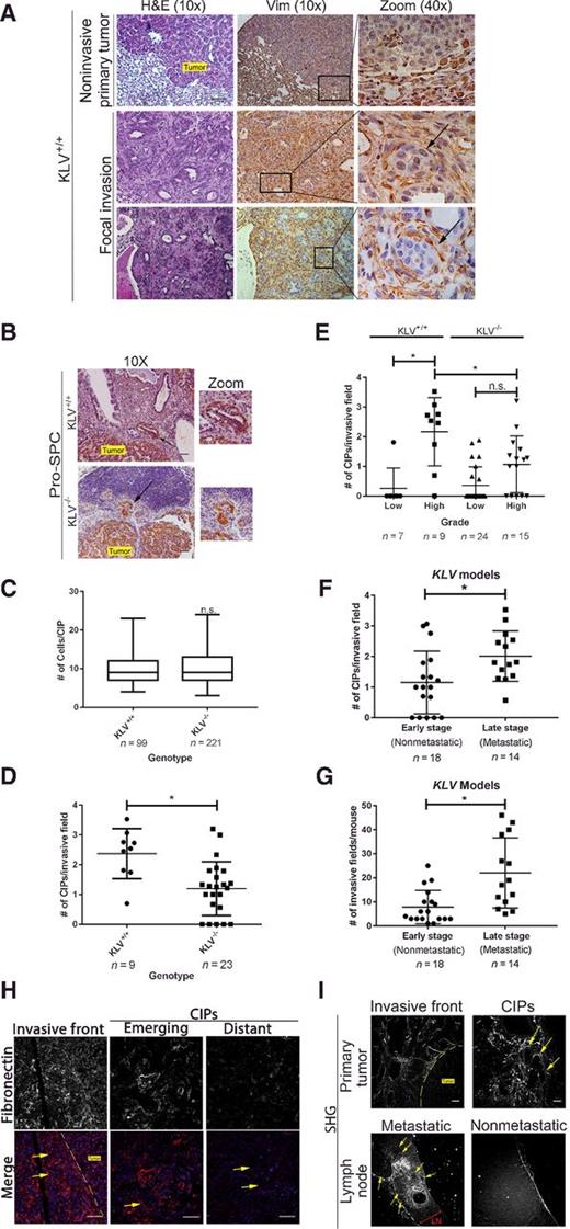 Vimentin Is Required for Lung Adenocarcinoma Metastasis via Heterotypic ...