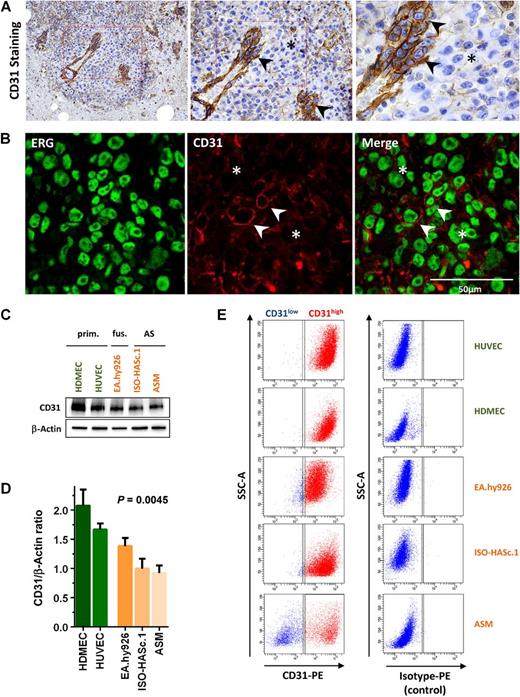 CD31 Expression Determines Redox Status and Chemoresistance in Human ...