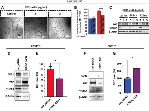 CD31 Expression Determines Redox Status and Chemoresistance in Human ...