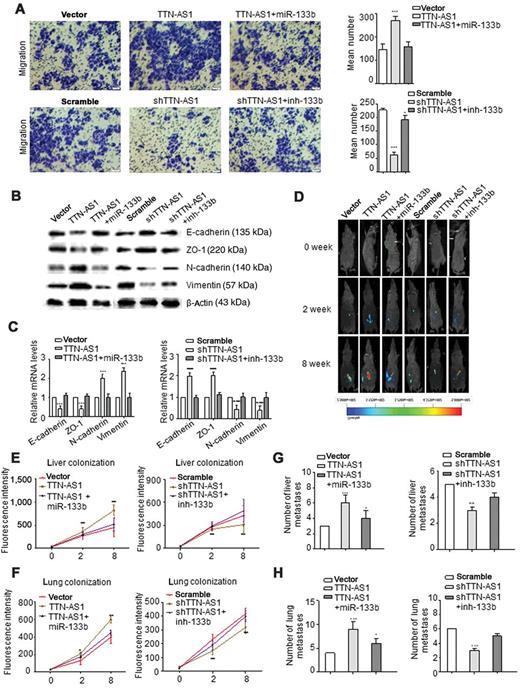 Functional Role of a Novel Long Noncoding RNA TTN-AS1 in Esophageal ...