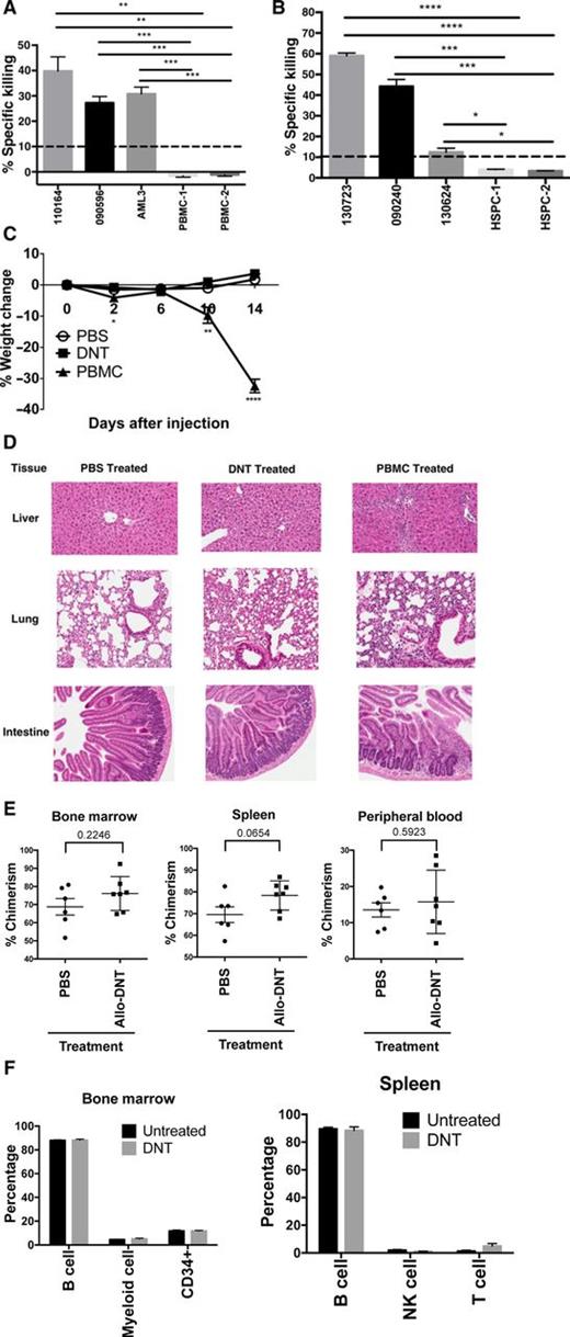 Allogeneic Human Double Negative T Cells as a Novel Immunotherapy for ...