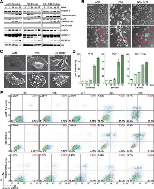 Molecular Targeted Therapies Elicit Concurrent Apoptotic and GSDME ...