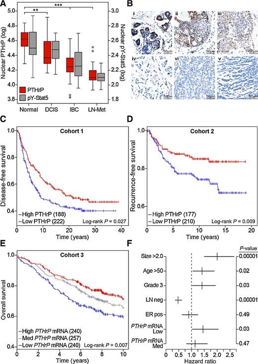 Loss of Nuclear Localized Parathyroid Hormone-Related Protein in ...