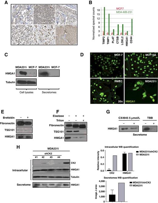 Extracellular HMGA1 Promotes Tumor Invasion and Metastasis in Triple ...