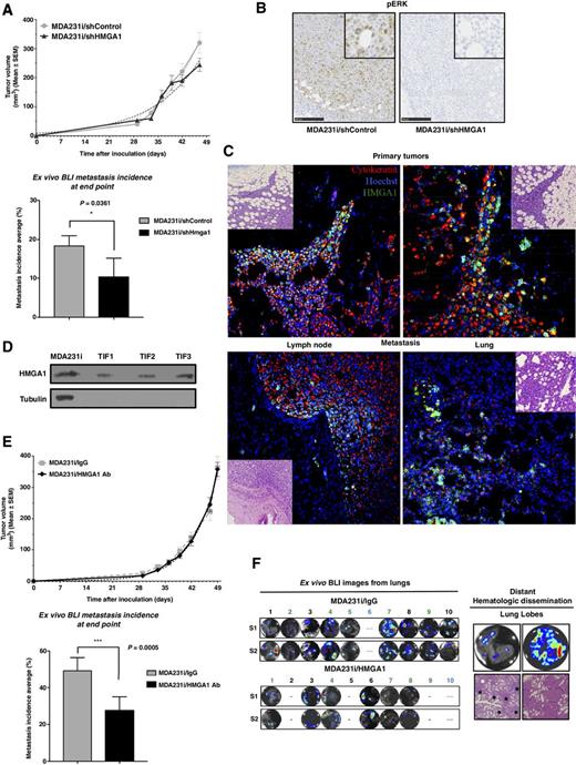 Extracellular HMGA1 Promotes Tumor Invasion and Metastasis in Triple ...