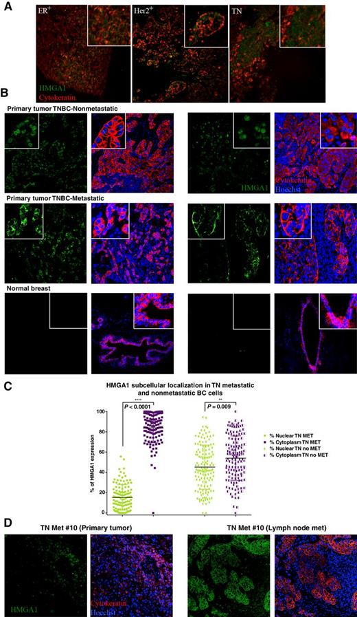 Extracellular HMGA1 Promotes Tumor Invasion and Metastasis in Triple ...