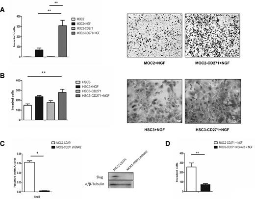 CD271 Confers an Invasive and Metastatic Phenotype of Head and Neck ...