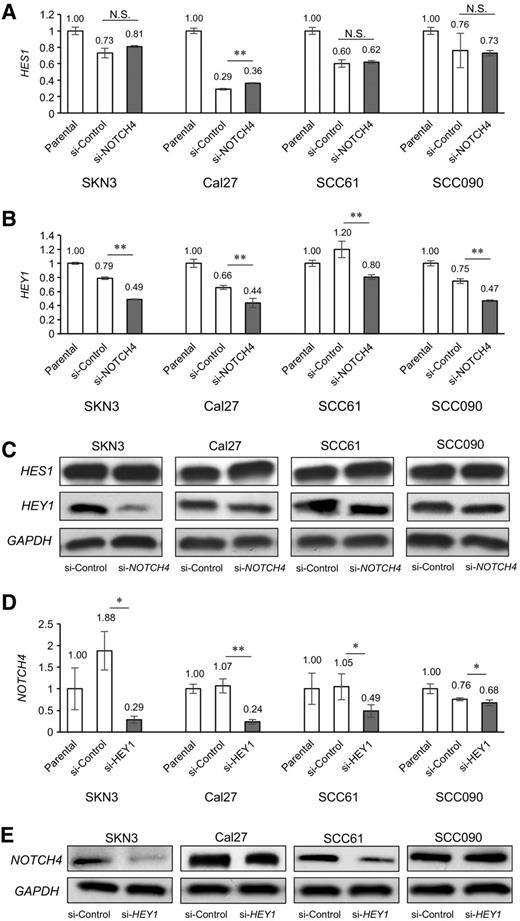 The NOTCH4–HEY1 Pathway Induces Epithelial–Mesenchymal Transition in ...