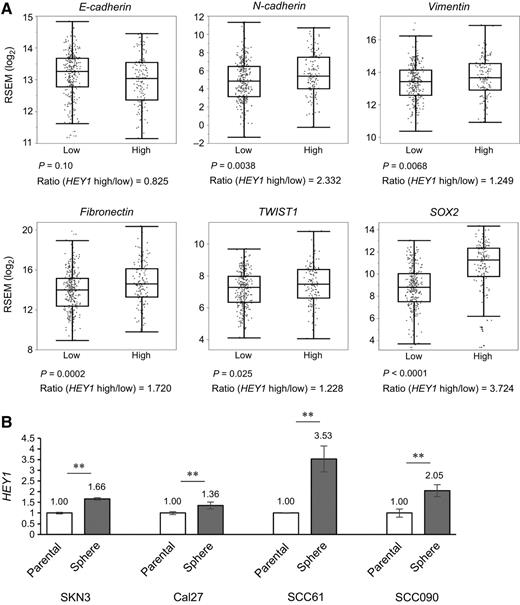 The NOTCH4–HEY1 Pathway Induces Epithelial–Mesenchymal Transition in ...