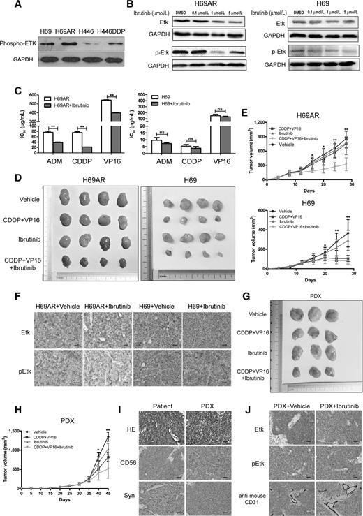 Etk Interaction with PFKFB4 Modulates Chemoresistance of Small-cell ...