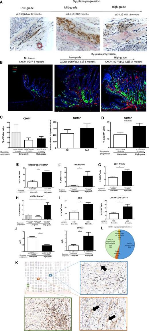 CXCR4 Is a Potential Target for Diagnostic PET/CT Imaging in Barrett's ...