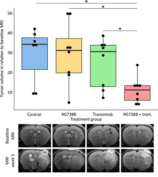 Targeting Resistance against the MDM2 Inhibitor RG7388 in Glioblastoma ...