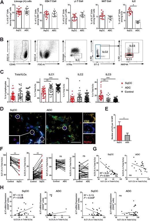 IL23-Producing Human Lung Cancer Cells Promote Tumor Growth via ...