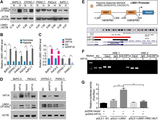 LIMS1 Promotes Pancreatic Cancer Cell Survival under Oxygen–Glucose ...