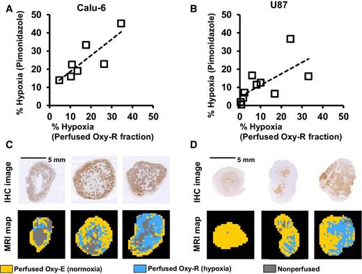 Oxygen-enhanced MRI Is Feasible, Repeatable, and Detects Radiotherapy ...
