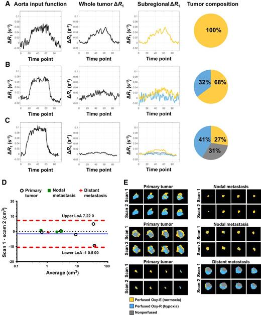 Oxygen-enhanced MRI Is Feasible, Repeatable, and Detects Radiotherapy ...