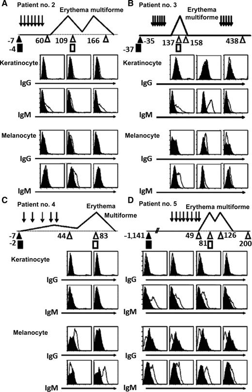 Mogamulizumab Treatment Elicits Autoantibodies Attacking the Skin in ...