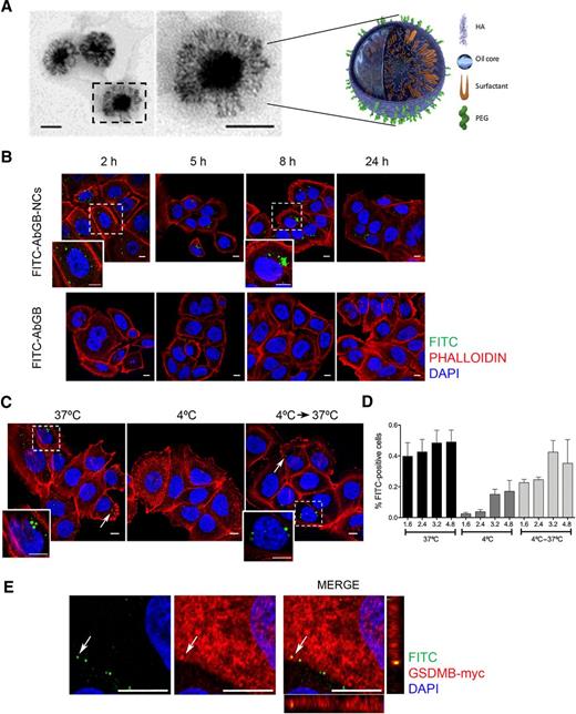 Intracellular Delivery of an Antibody Targeting Gasdermin-B Reduces ...