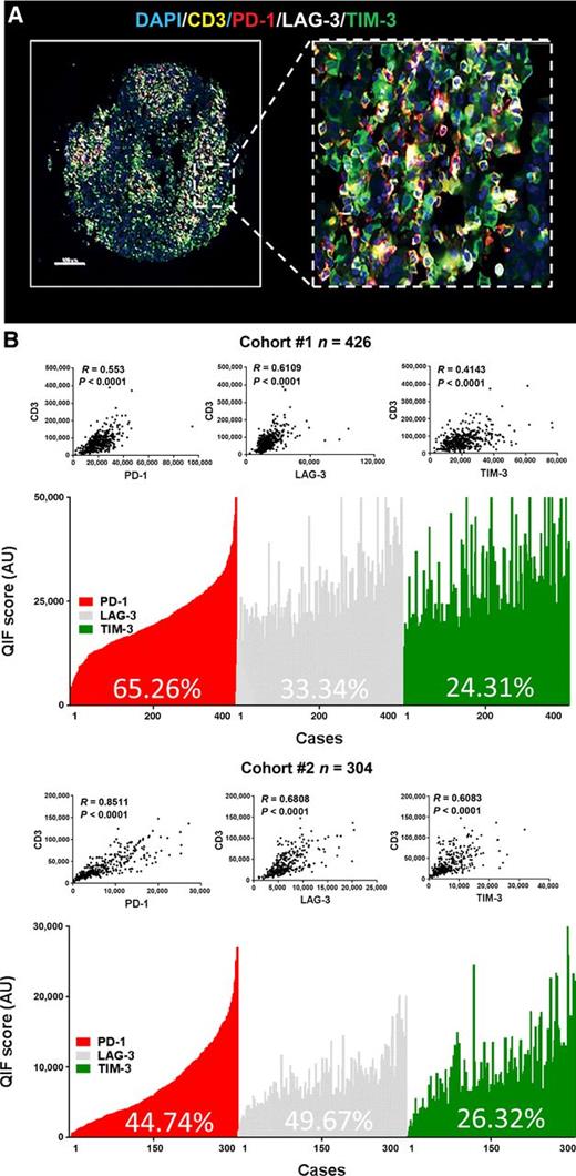 Expression Analysis and Significance of PD-1, LAG-3, and TIM-3 in Human ...