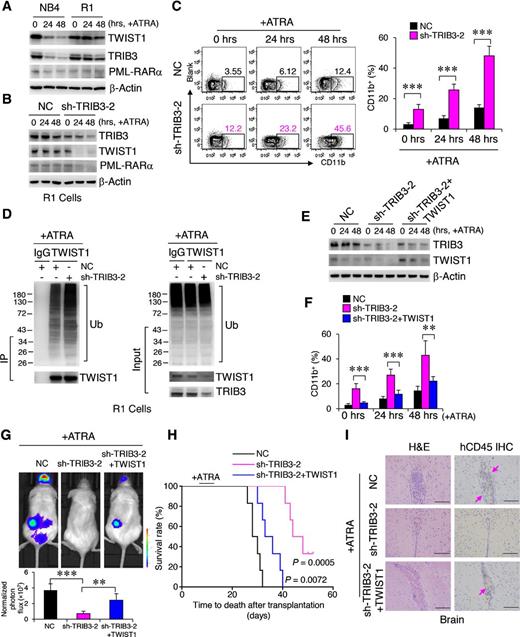 TRIB3 Stabilizes High TWIST1 Expression to Promote Rapid APL ...
