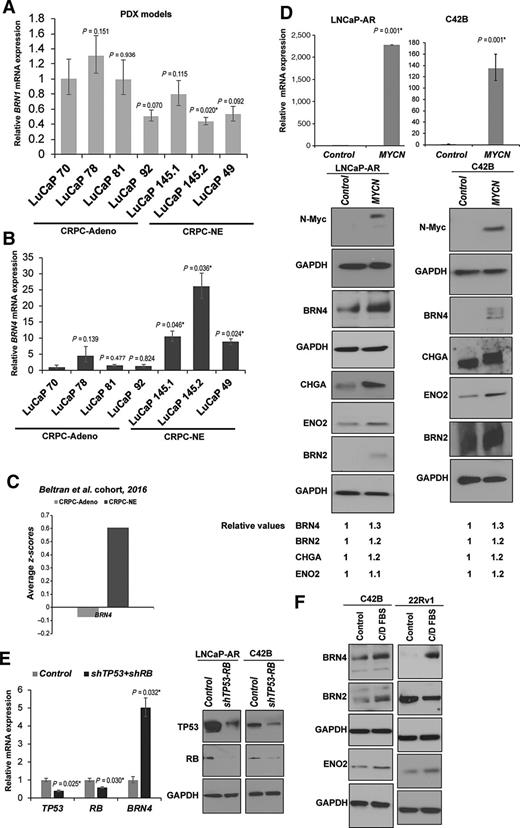 BRN4 Is a Novel Driver of Neuroendocrine Differentiation in Castration ...