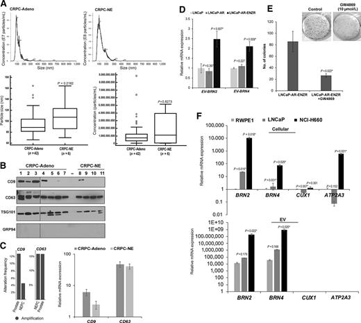 BRN4 Is a Novel Driver of Neuroendocrine Differentiation in Castration ...