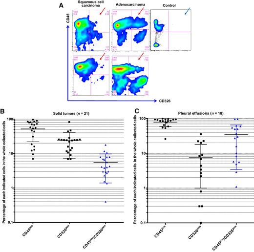 CD45+CD326+ Cells are Predictive of Poor Prognosis in Non–Small Cell ...