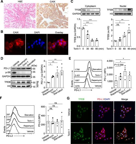TFEB Mediates Immune Evasion and Resistance to mTOR Inhibition of Renal ...