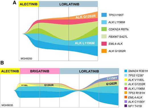 Treatment with Next-Generation ALK Inhibitors Fuels Plasma ALK Mutation ...
