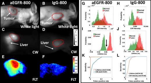 Fluorescence Lifetime-Based Tumor Contrast Enhancement Using an EGFR ...